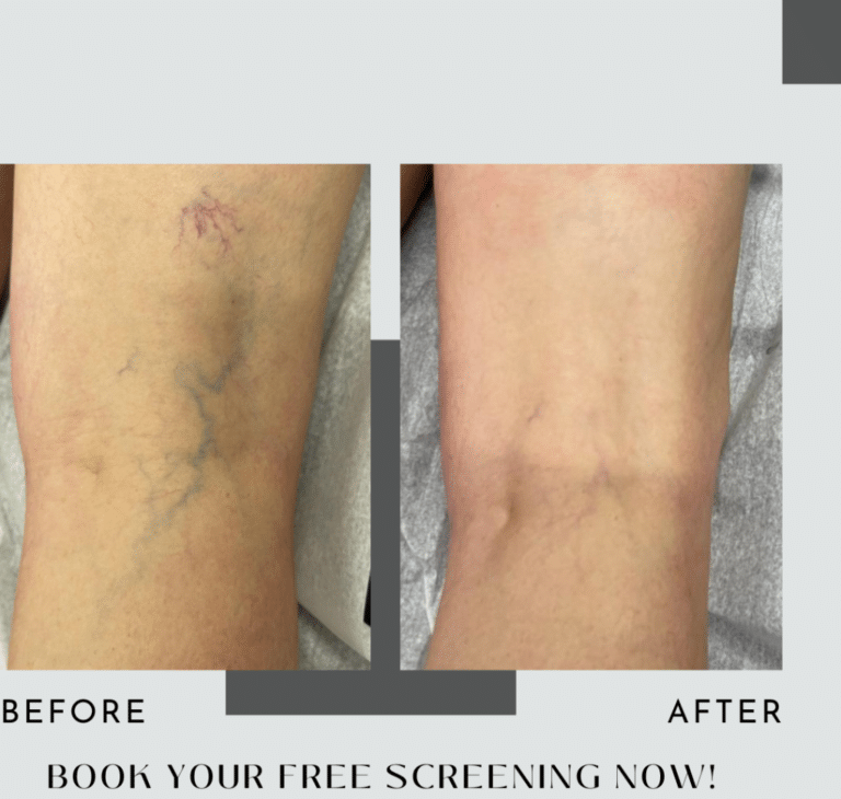 7 Warning Signs of Deep Vein Thrombosis (DVT) - Salcedo Medical Center ...