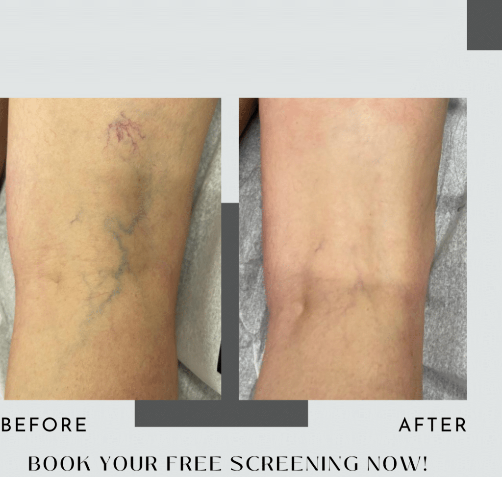 7 Warning Signs of Deep Vein Thrombosis (DVT) - Salcedo Medical Center ...